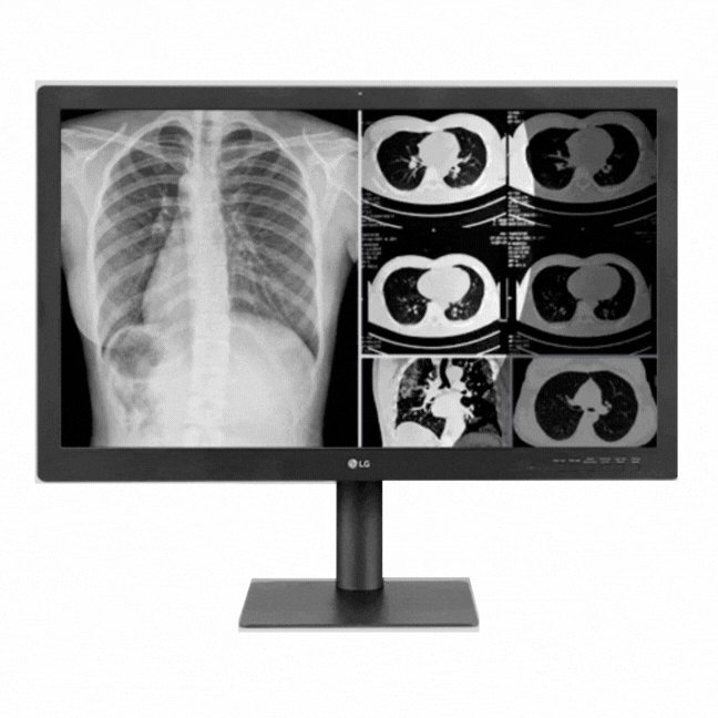 Lg 315 8mp Diagnostic Ips Black Monitor