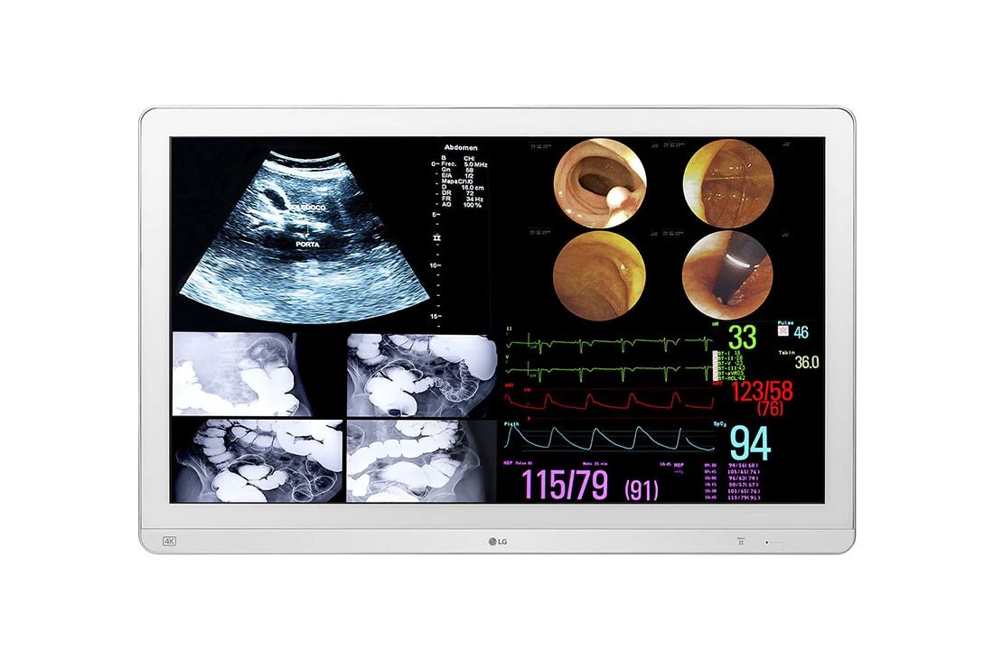Medical Monitors: Hospital Monitors for Radiology & Surgical Displays