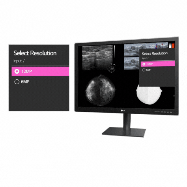 LG 31.5 " 8MP Diagnostic IPS Black Monitor